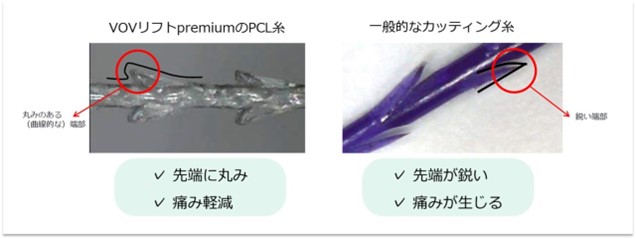 スレッドリフト（VOVリフト・4Dリフト） – 西三河の皮膚科・美容皮膚科｜あおい皮フ科クリニック｜肌・美容のお悩みに